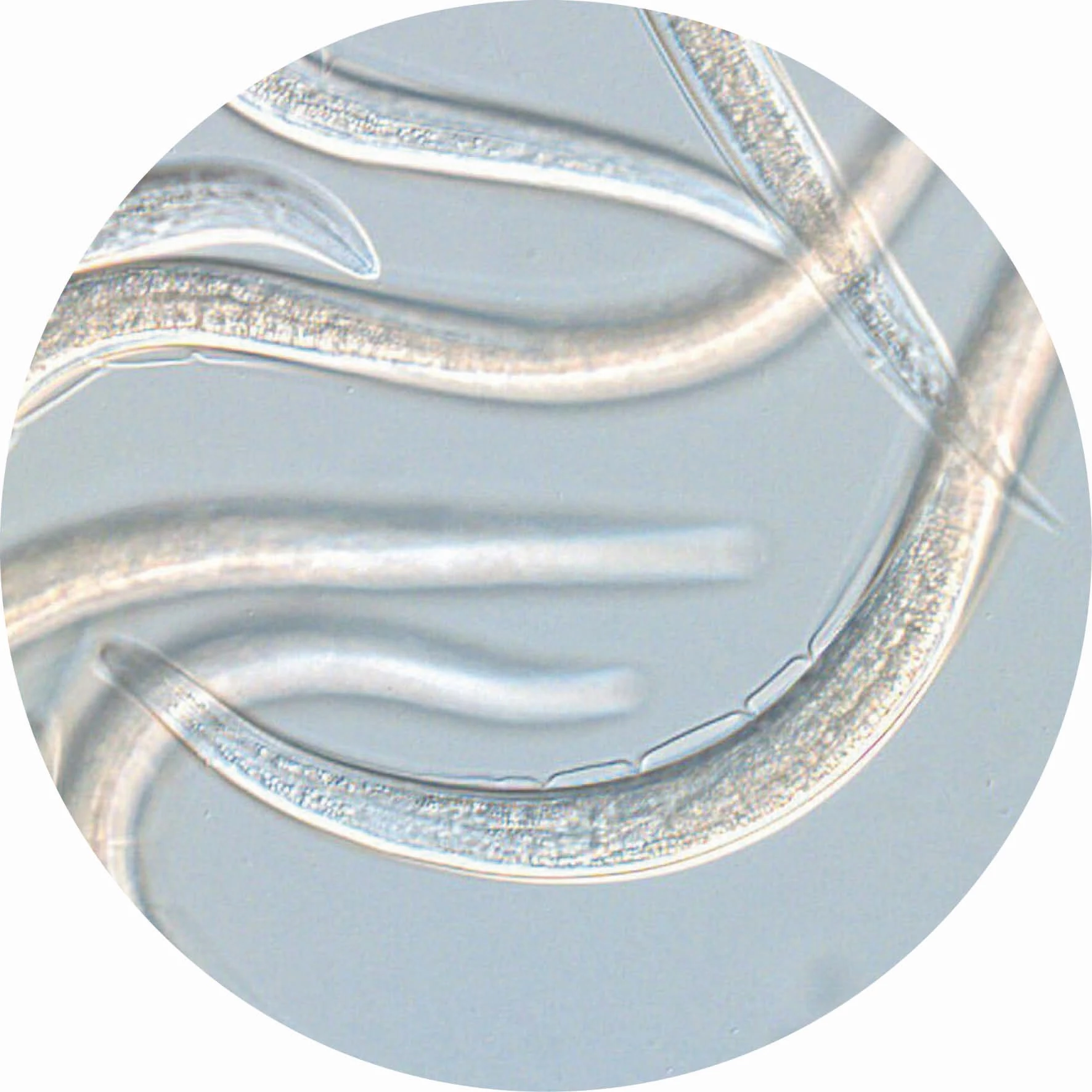 Aaltjes: wat doen ze & hoe gebruik je ze? - Tuincentrum Pelckmans